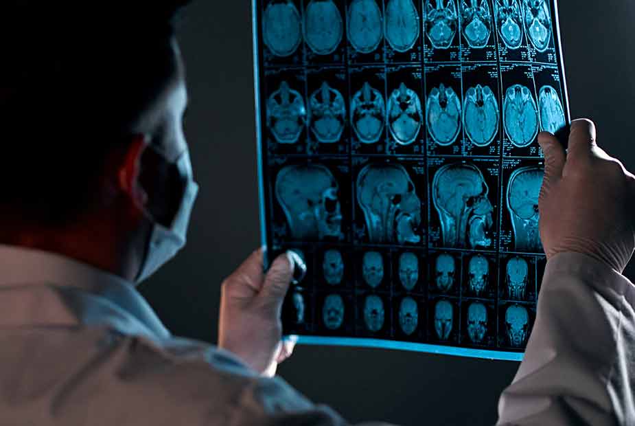 How Opioids and Heroin Change Brain Function: An In-depth Exploration ...